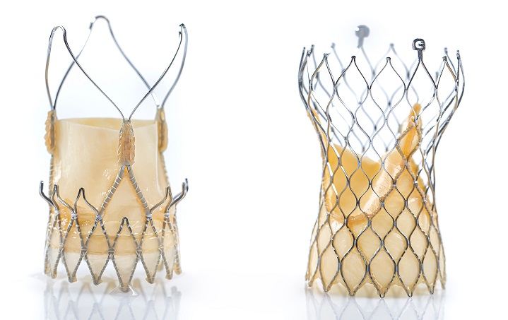 Vascular Access Device, Peripheral Vascular Stents, Endovascular Stent ...